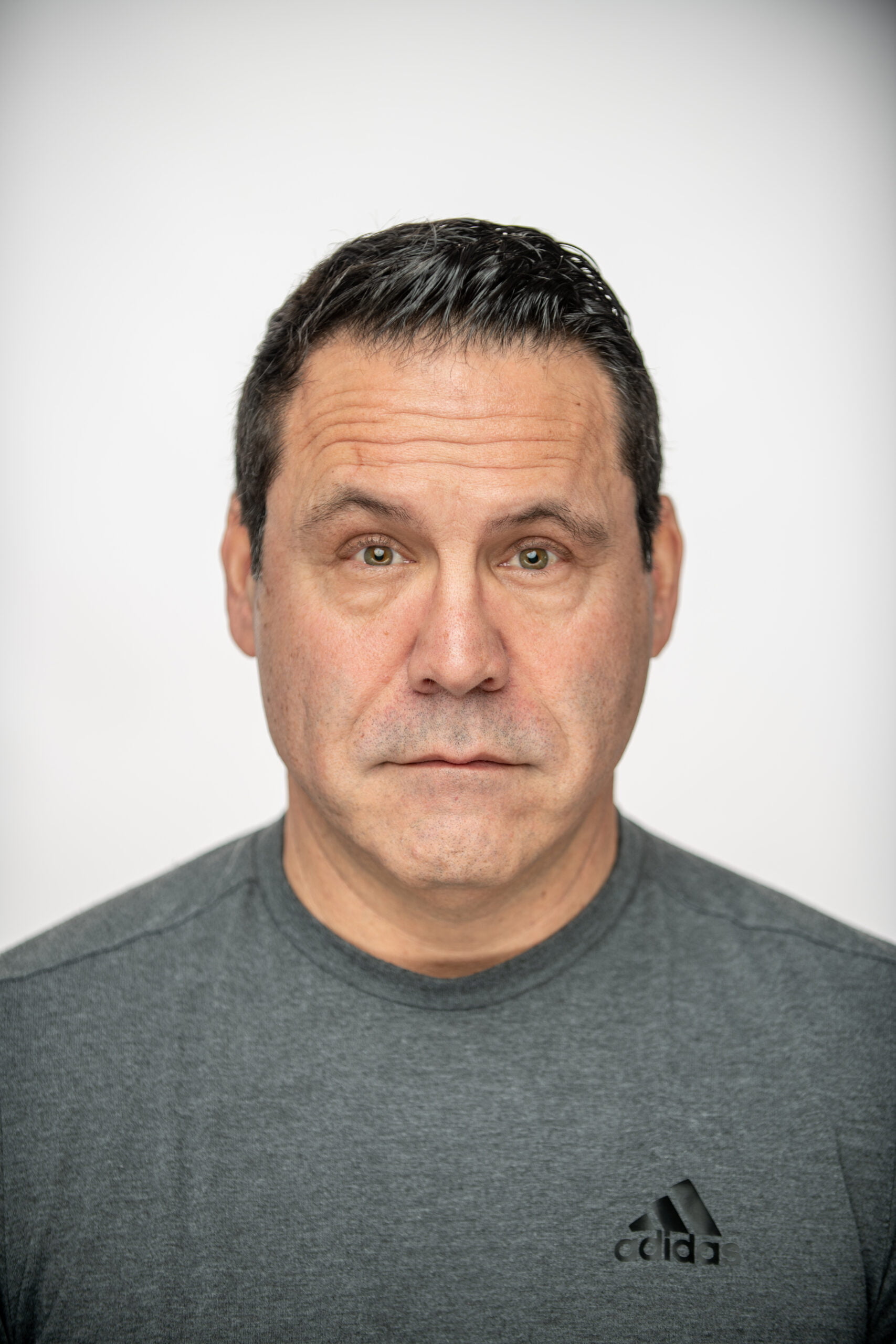 The Bro-Tox Guide: Why Men Should Embrace Botox at Recharge Clinic ...